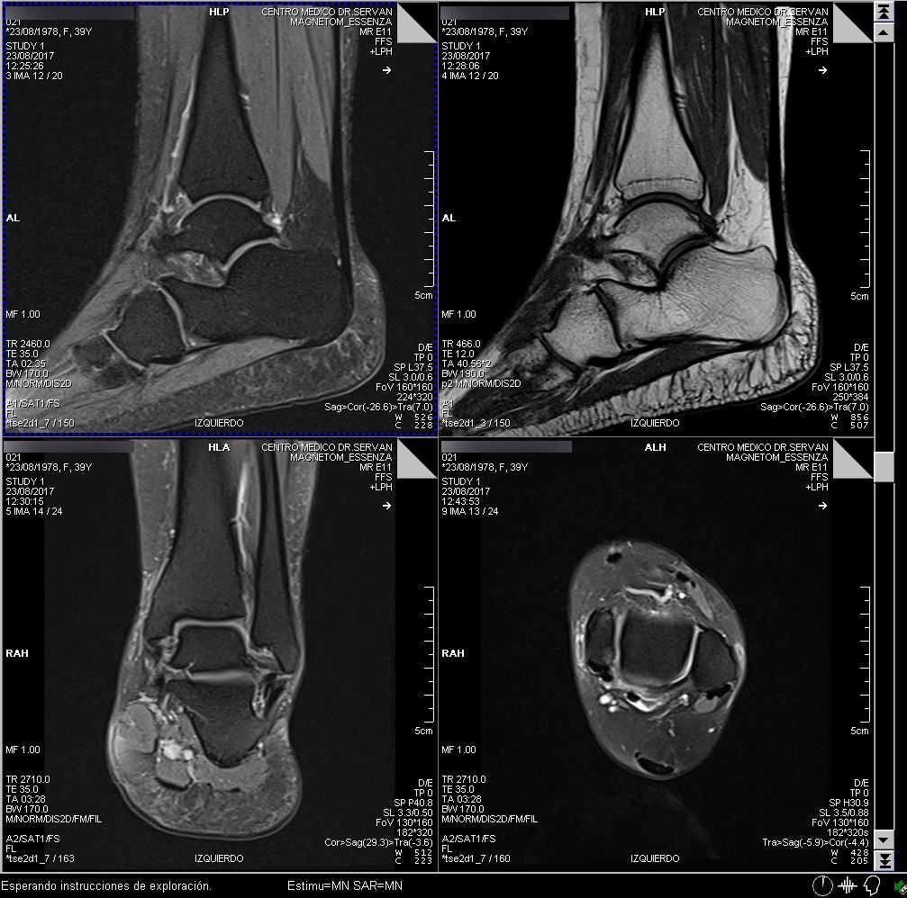 Resonancia Magnética – Tobillo - Centro Médico Dr. Serván