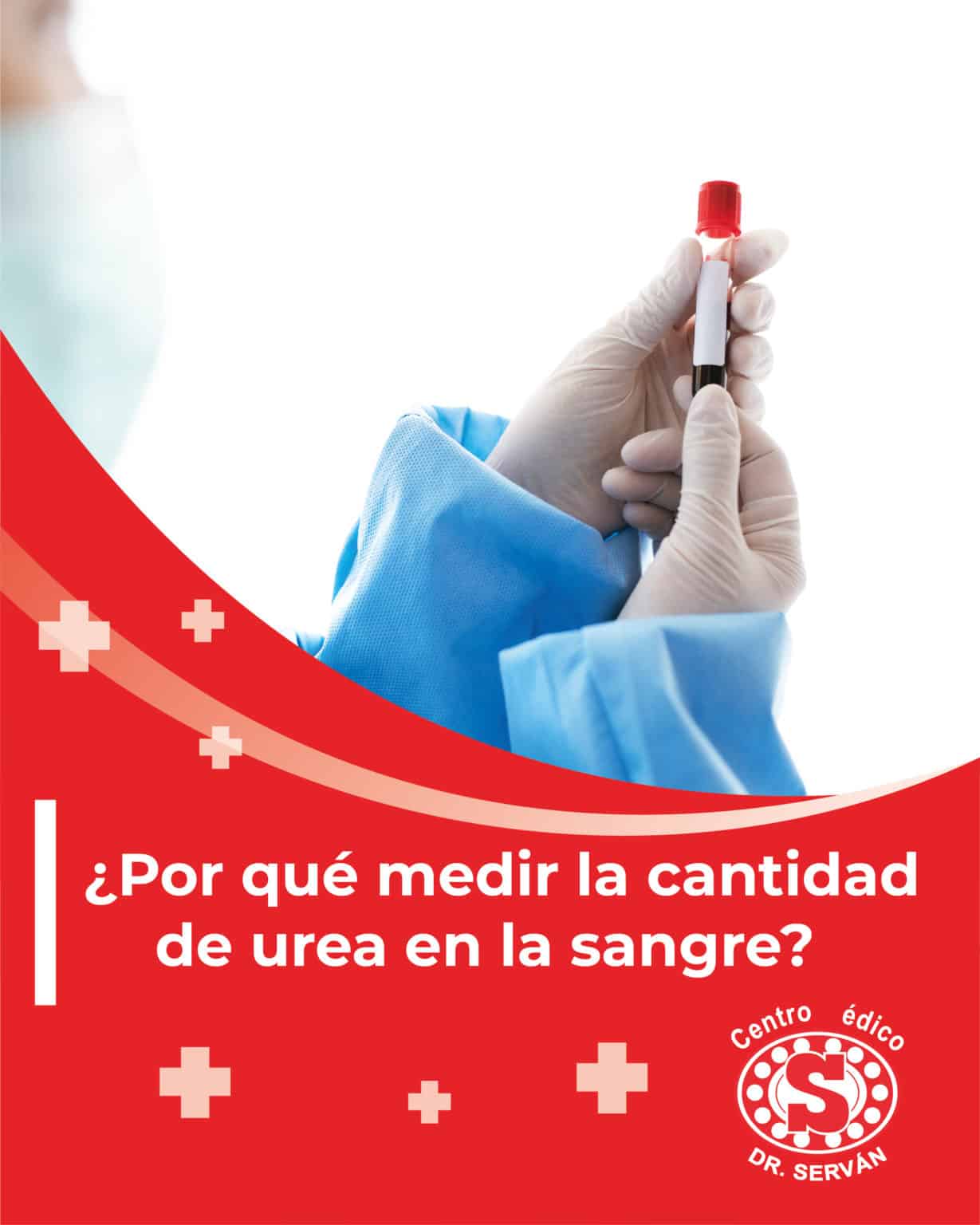¿Por qué medir la cantidad de urea en la sangre? - Centro Médico Dr. Serván