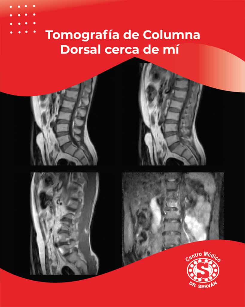 Tomografía de Columna Dorsal cerca de mí - Centro Médico Dr. Serván