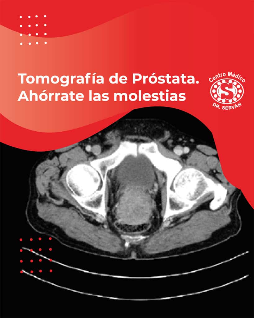Tomografía de Próstata. Ahórrate las molestias - Centro Médico Dr. Serván