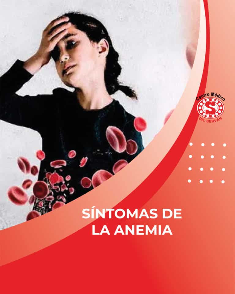 Síntomas de la anemia - Centro Médico Dr. Serván