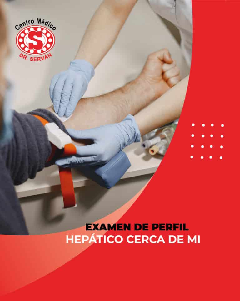 Examen de perfil hepático cerca de mi - Centro Médico Dr. Serván