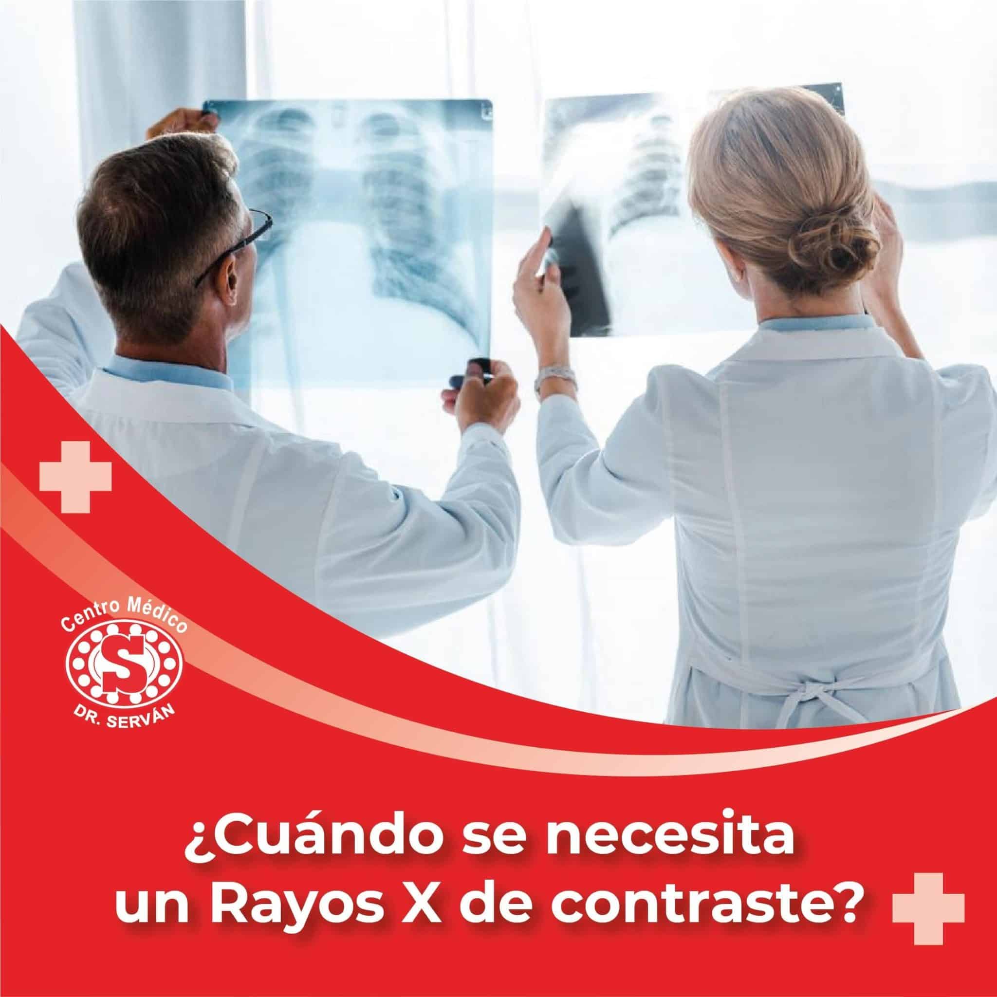 ¿Cuándo se necesita un RX de contraste? - Centro Médico Dr. Serván