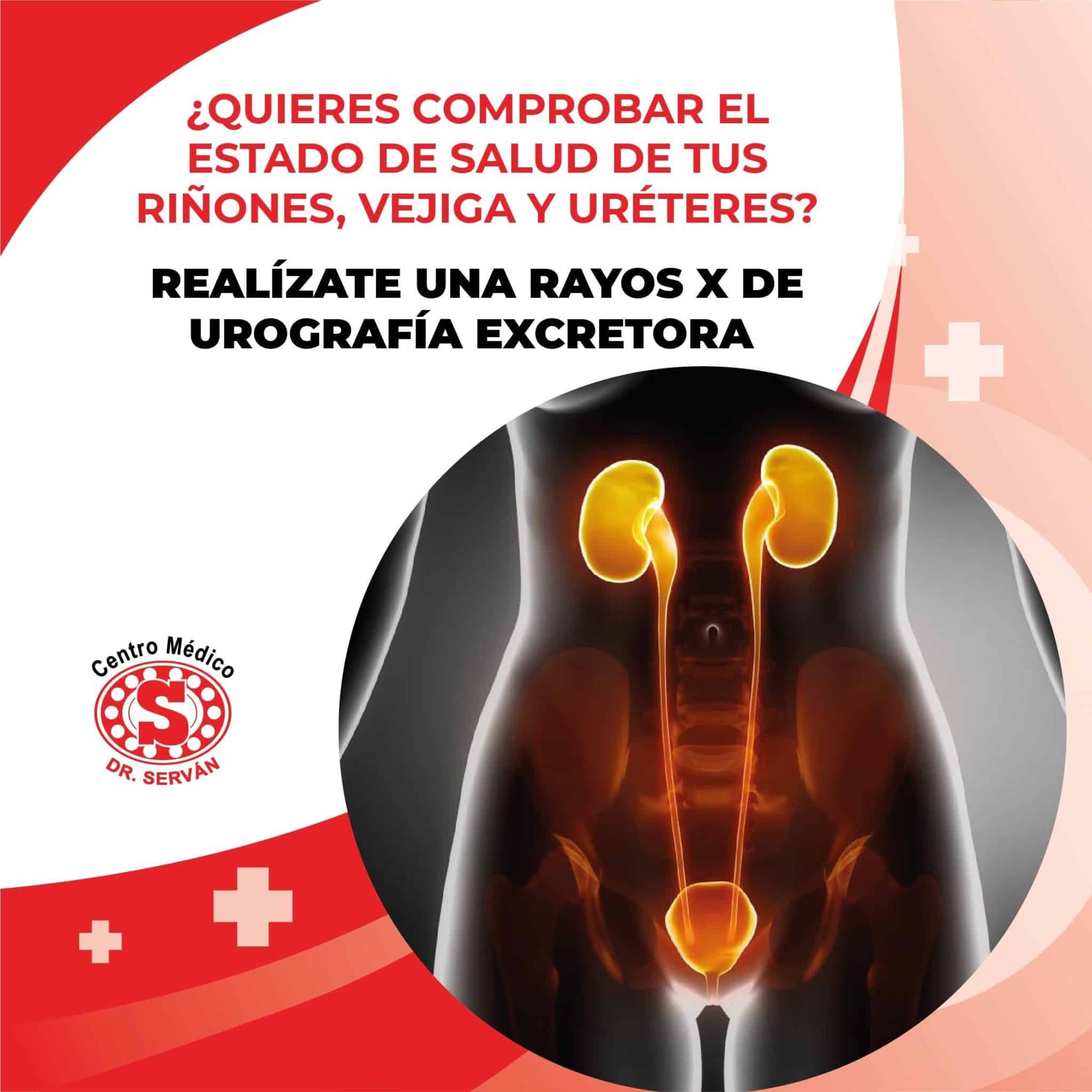 ¿Quieres comprobar el estado de salud de tus riñones, vejiga y uréteres ...