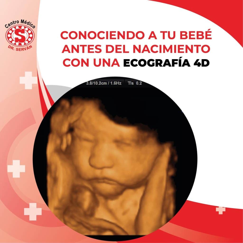 Conociendo a tu bebé antes del nacimiento con una Ecografía 4D - Centro ...