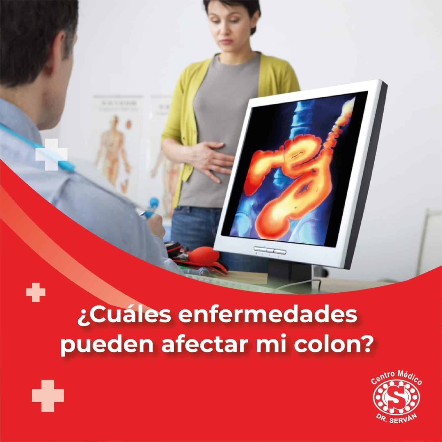 ¿Cuáles enfermedades pueden afectar mi colon? - Centro Médico Dr. Serván