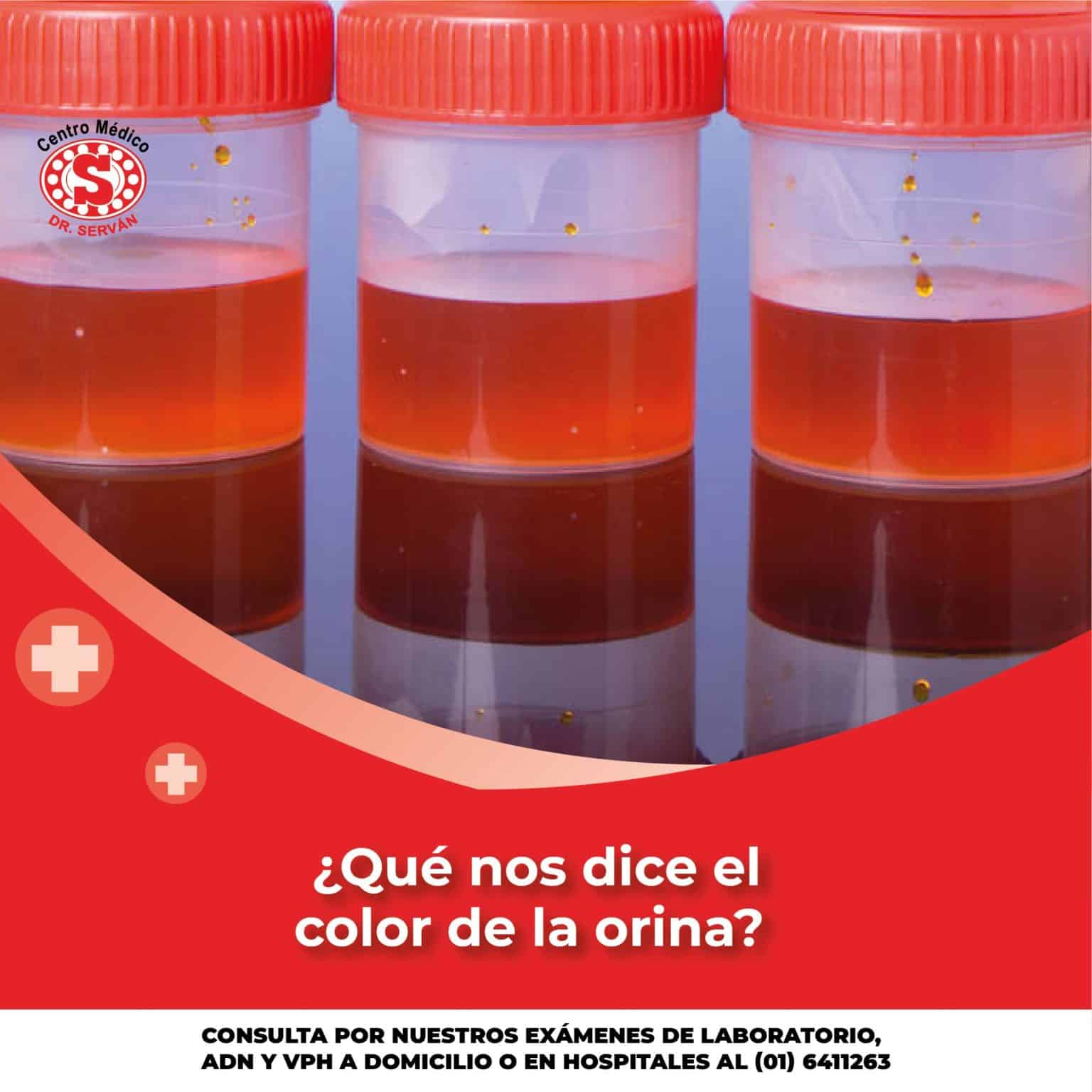 ¿Qué nos dice el color de la orina? - Centro Médico Dr. Serván