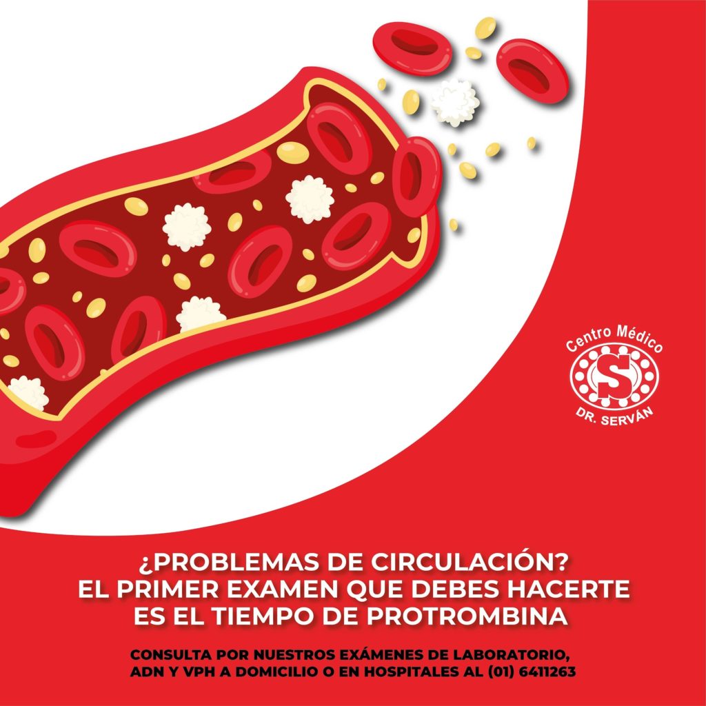 ¿Problemas de circulación? El primer examen que debes hacerte es el ...